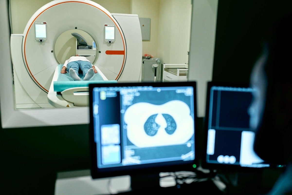 How AI is Transforming the Future of Cancer Medical Treatment